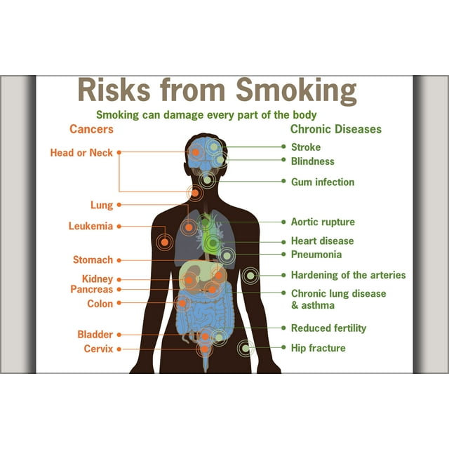 24"x36" Gallery Poster, health Risks from smoking cdc diagram cancer ...