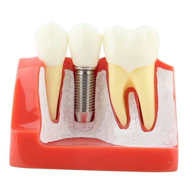 Dental Patient Education Models
