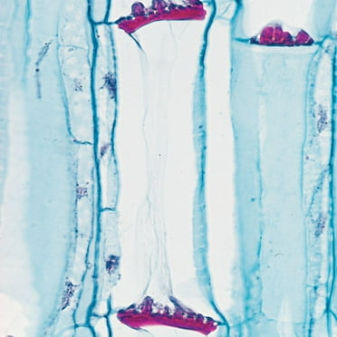 Mixed Diatoms Prepared Microscope Slide, Whole Mount - Walmart.com