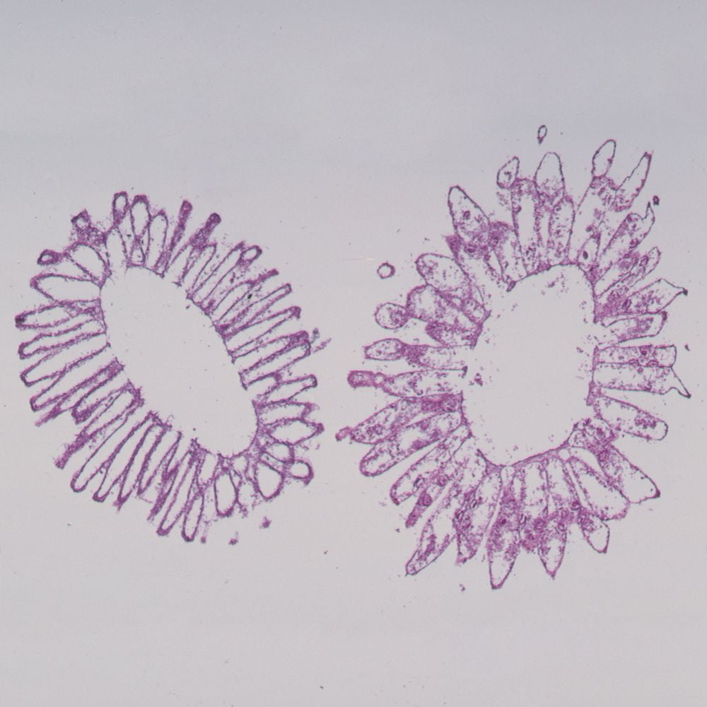 Grantia (Scypha), C.S. Microscope Slide - Walmart.com