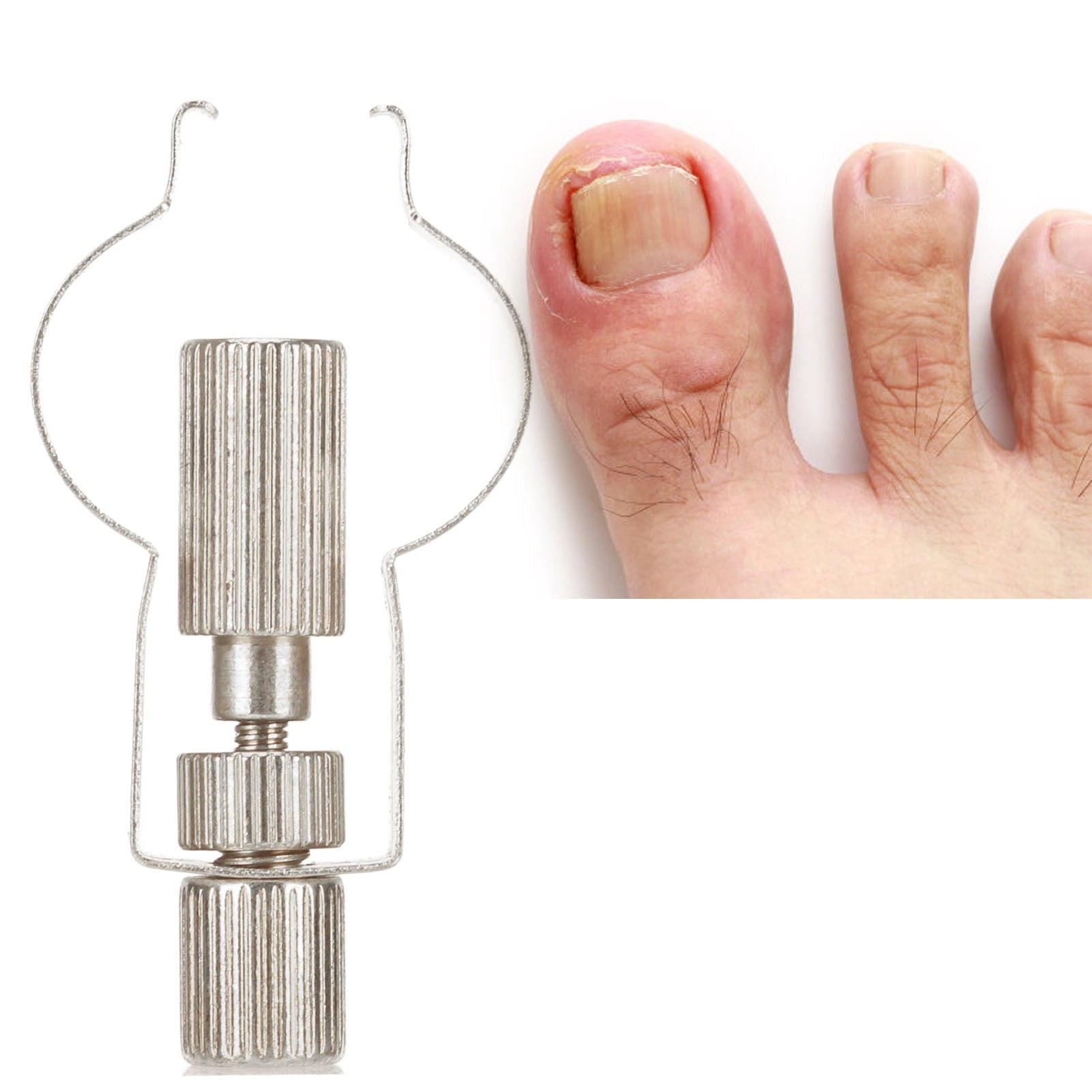 Click here for Estink Professional Ingrown Toenail Lifter Stainle... prices