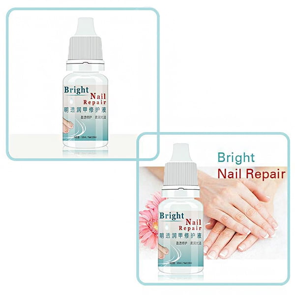 Buy 2Pcs Anti Fungal Treatment Extra Strength Toenail Fungus Athletes ...