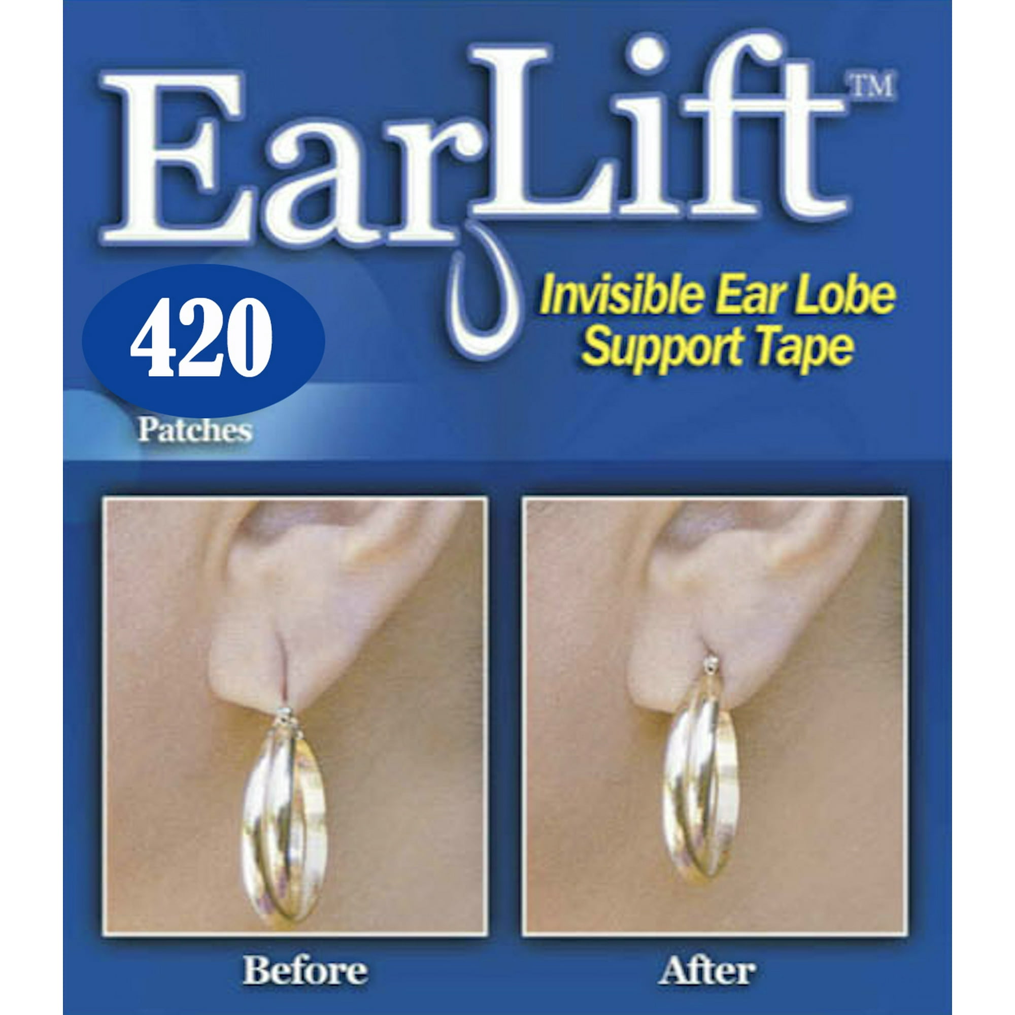 Click here for Earlift Earring Support Patches Stretched And Droo... prices