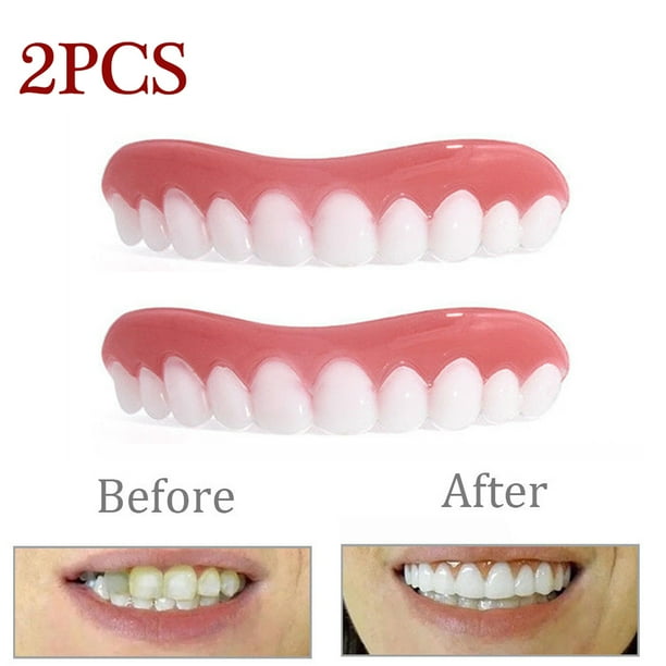 clip-on-veneers