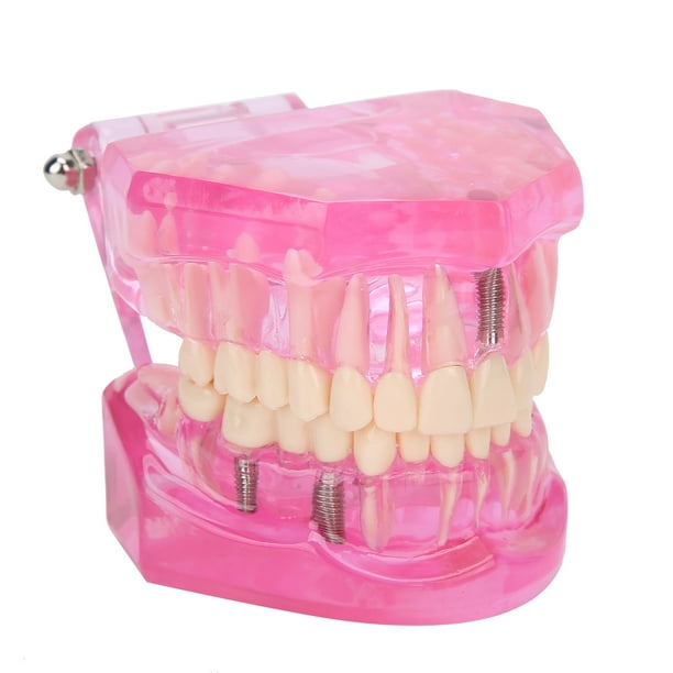 Model, Detailed Portable Adult Teeth Model Transparent For Teaching For ...