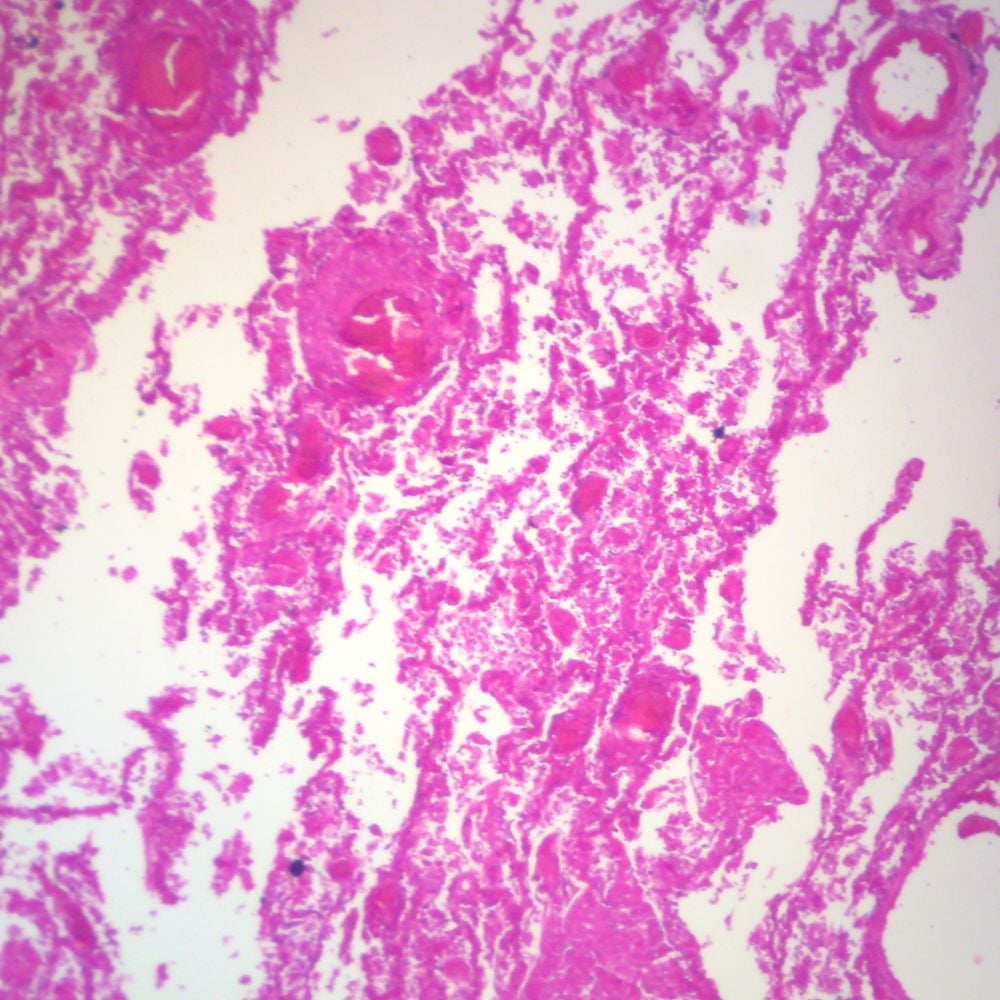 Lung Microscope Slide