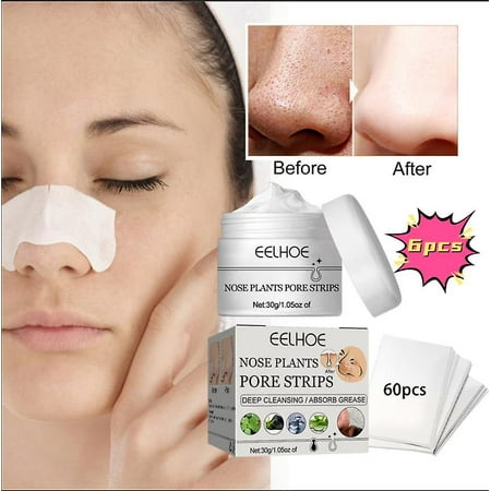Eelhoe Blackhead Removing Nasal Mask To Suction Blackheads And Acne ...
