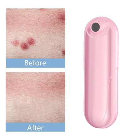 suntekmall Compact Bites Itch Device Bite Pen Bite Device for Pink ...