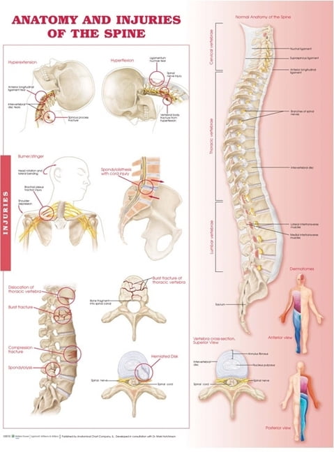 Anatomy and Injuries of the Spine Anatomical Chart - Walmart.com