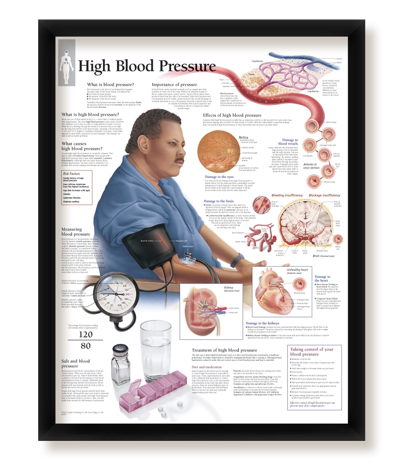 High Blood Pressure Framed Medical Educational Informational Poster ...