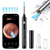 KEKOY Ear Camera and Wax Remover, 1080P Ear Wax Removal Kit, Wireless ...