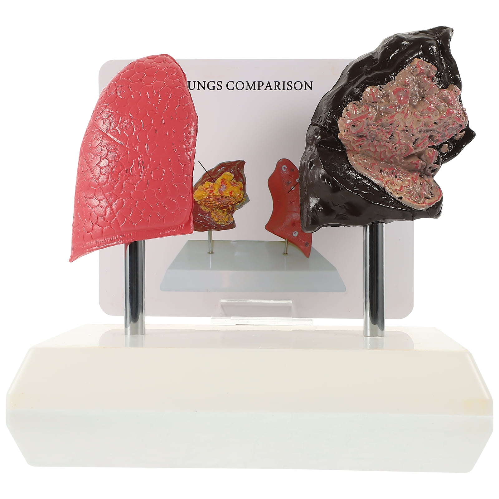 Click here for Ounona 1 Pc Smoking Lung And Normal Lung Compariso... prices