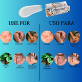 Gelmicin Cream, Hydrocortisone 1% Anti-Itch Relief, Eczema, Psoriasis ...
