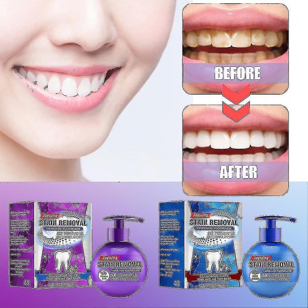 Jaysuing 2 Pack Whitening Toothpaste for Bleeding Gums and Removing ...