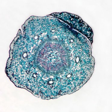 Mixed Diatoms Prepared Microscope Slide, Whole Mount - Walmart.com