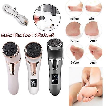 Electric Feet Callus Removers Rechargeable Foot File Pedicure Tools ...