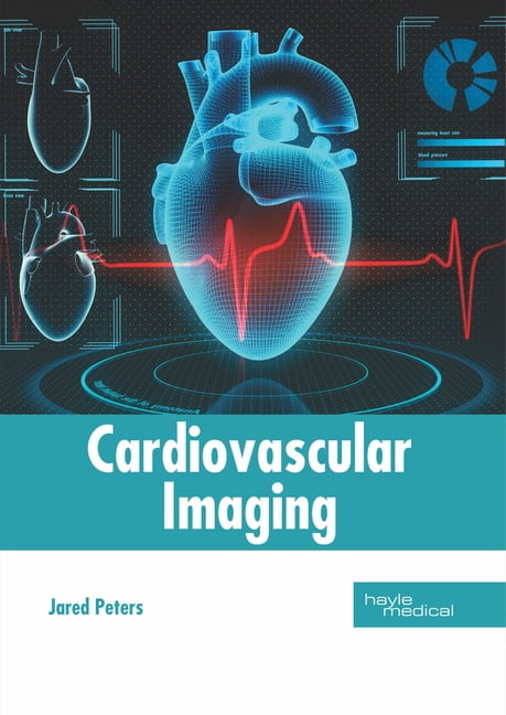 Cardiovascular Imaging (Hardcover) - Walmart.com