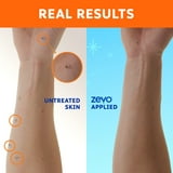 Zevo On Body Mosquito + Tick Repellent - Bug Spray - 6oz Aerosol Spray ...