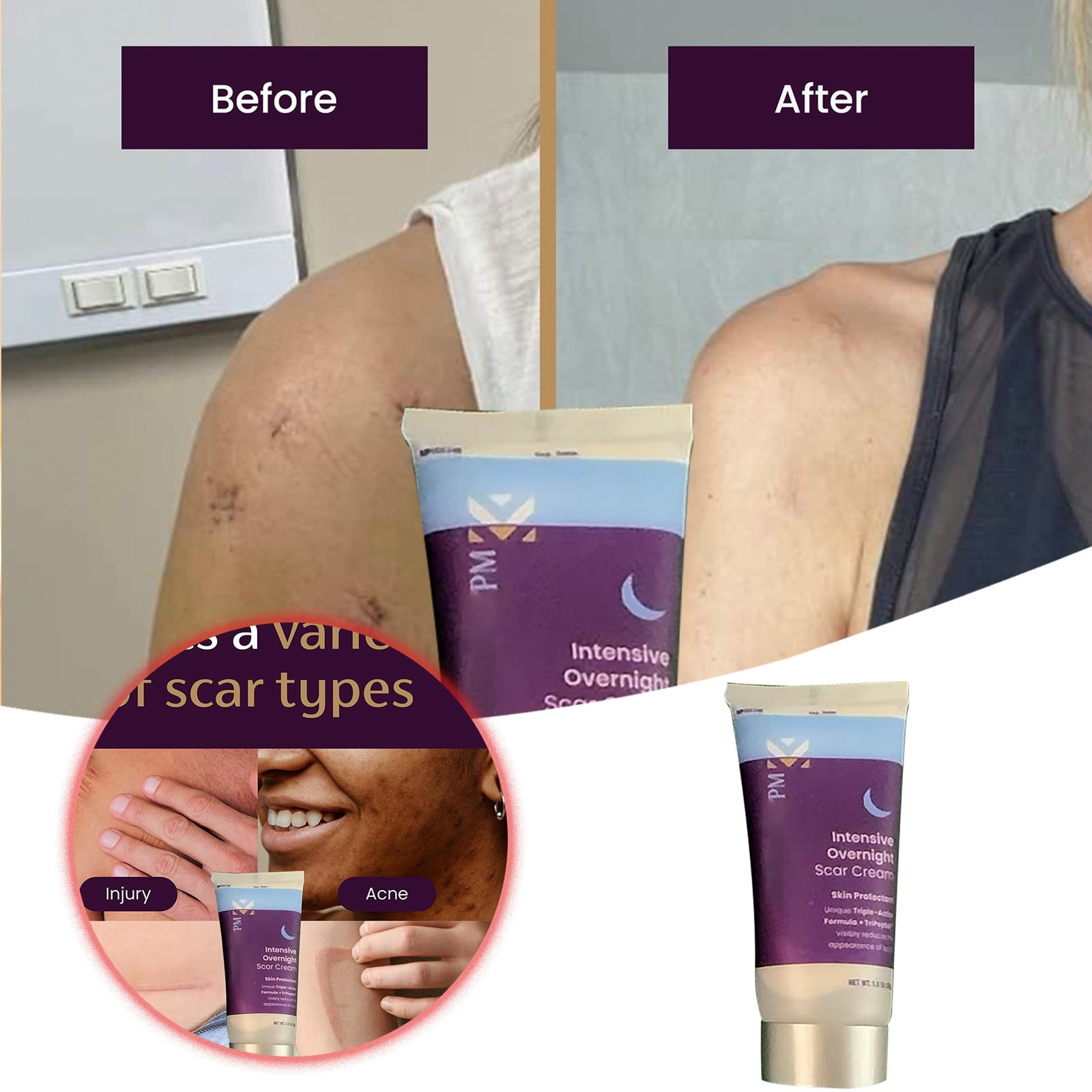 SDHJKSIN Intensive Overnight Scar Works With Skin's Nighttime ...