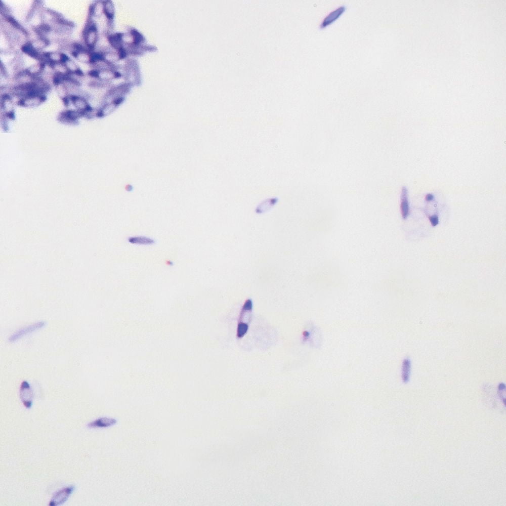 Clostridium Botulinum, W.M. Microscope Slide - Walmart.com