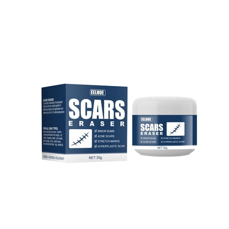 3 pcs Scar Eraser Cream - Ideal for Stretch Marks / Acne scars / Burns ...