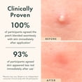 Rael Hydrocolloid Acne Patch Invisible Spot Cover for All Skin Types 24 ...