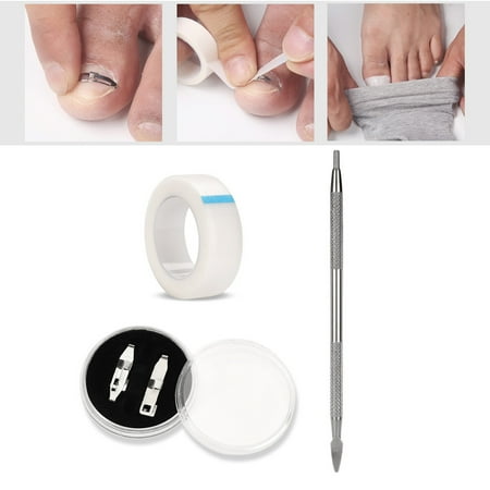 Aofa Professional Ingrown Toenail Correction Treatment Kit,Ingrown ...