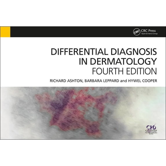 Pre-Owned Differential Diagnosis in Dermatology (Paperback) 1909368725 9781909368729 - Walmart.com