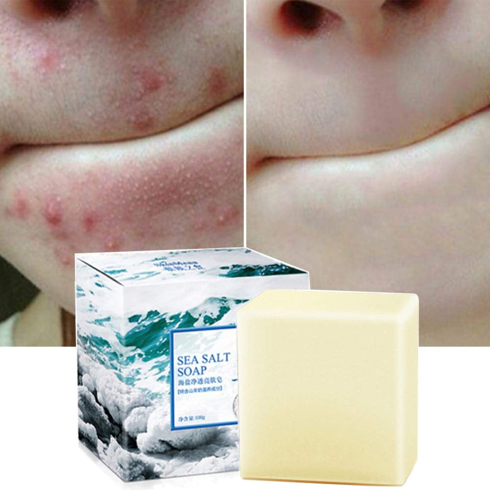 Sea Salt Soap 3.5 Oz Each, Exfoliating Acne Deeply Clean Problem Skin ...