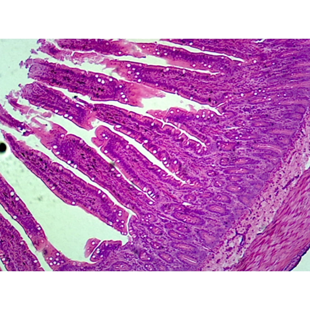 Jejunum, Mammalian; Showing Plicae Circulares; Section - Walmart.com ...