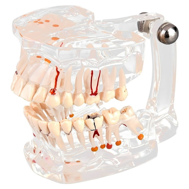Dental Patient Education Models