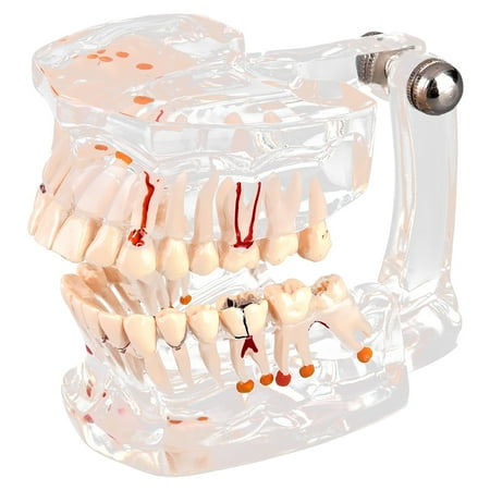 Tooth Model, Model Teeth Teaching Model Teeth Demonstration Model with ...