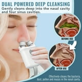 NasalFresh MD Premium Dual Powered Nasal Irrigation System, Self ...