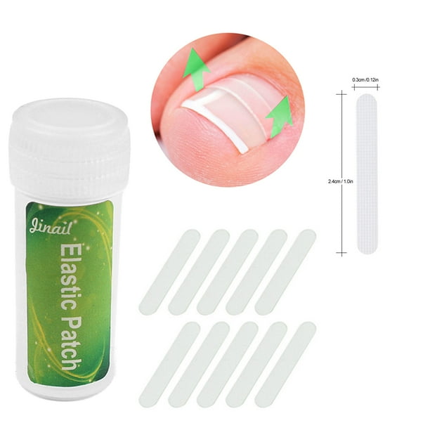 10Pcs Ingrown Toenail Straightening Clip Ingrown Toenail Correction ...