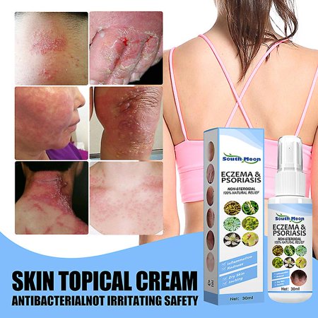Herbal Ringworm Treatment Spray Fights Ringworm On Skin Powerful ...
