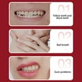 Erosion Control Polish Tooth Cavity Toothpaste for Dogs Small Breed ... Erosion Control Polish Tooth Cavity Toothpaste for Dogs Small Breed ...