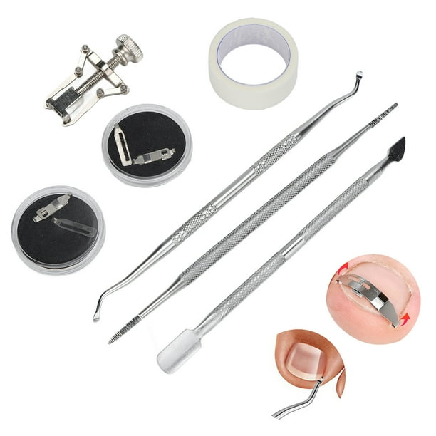 ANGGREK Ingrown Toenail Treatment Kit,Ingrown Toenail Lifter,Ingrown ...