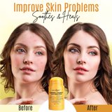 Turmeric Mask Stick, Detox Clay Face Mask, Reduce Acne and Scars Mask ...