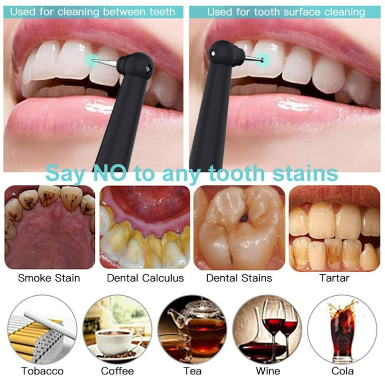 Black Calculus Teeth