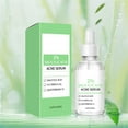 Langruiwanju Pulchritude New! Acne Serum 30ML 2% Salicylic BHA-acid ...