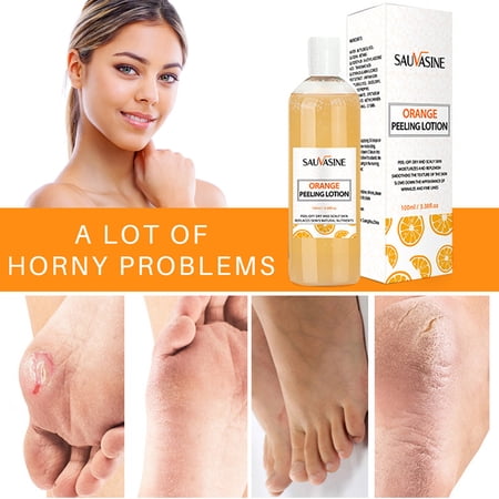 megalia 100ml Orange Peeling Lotion Remove Dark Skin Exfoliating ...
