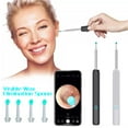 Wirel HD Ear Wax Remover Camera Ear Endoscope Spoon Pi Kit Cleaning ...