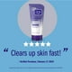 Clean & Clear Continuous Control Benzoyl Peroxide Acne Face Wash, 5 oz ...