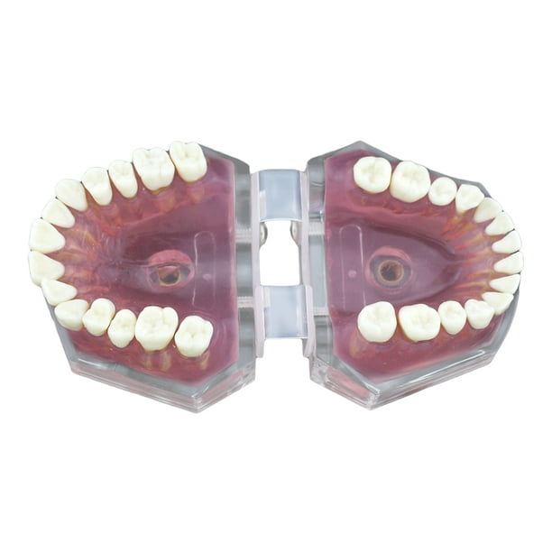 Dental Patient Education Models