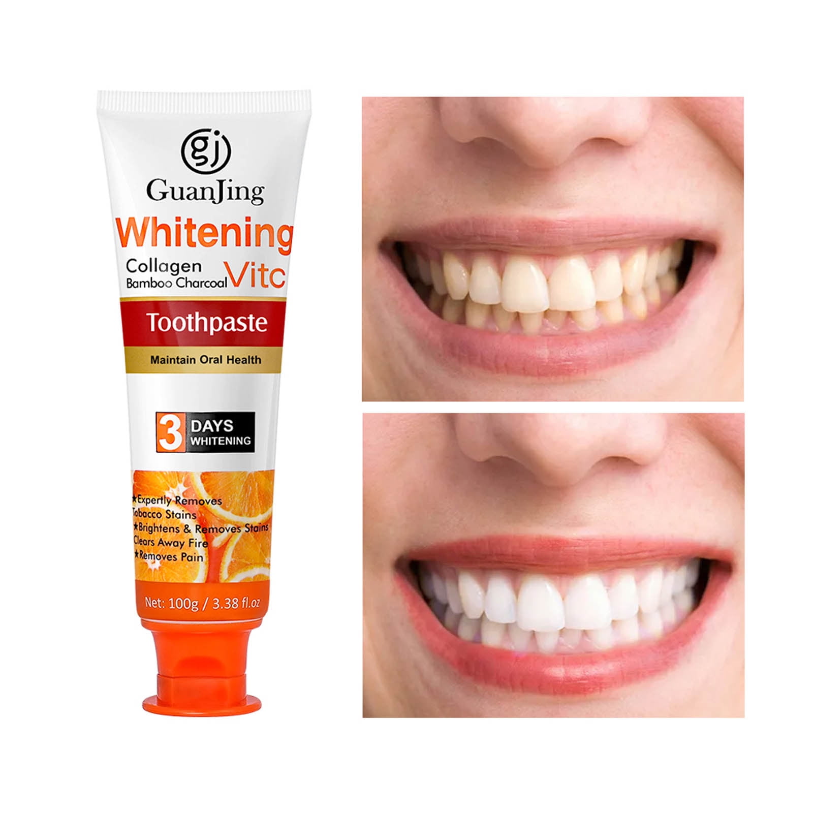 Kokovifyves toothpaste Improves tooth Enamel and tooth Sensitivity with ...