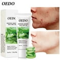 2 Pack Natural Aloe Vera Soothing And Moisturizing Skin Gel 100 Pure