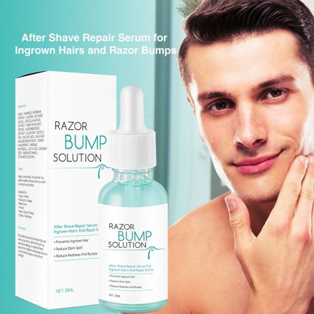Bump Solution After Shave Solution 30ml Anti Hair Ingrown Serum Bump ...