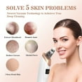 Yoland Face Vacuum Pore Cleaner White Heads Removal With 3 Modes And 4 Suction Heads Extractions