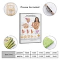 Anatomical Poster The Female Breast Posters Posters Wall Art Painting ...