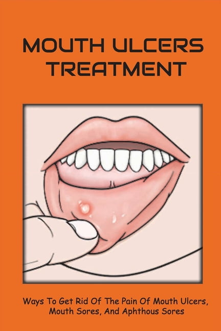 Aphthous Stomatitis Treatment
